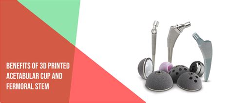 Benefits Of 3d Printed Acetabular Cup And Femoral Stem 3dincredible