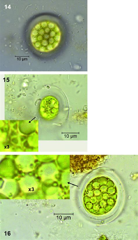 Regular Arrays Of Small Chloroplast Or Pyrenoid Like Structures Fig Download Scientific