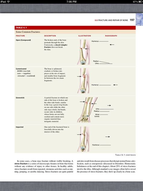Chapter 6 Skeletal System Bones And Bone Tissue