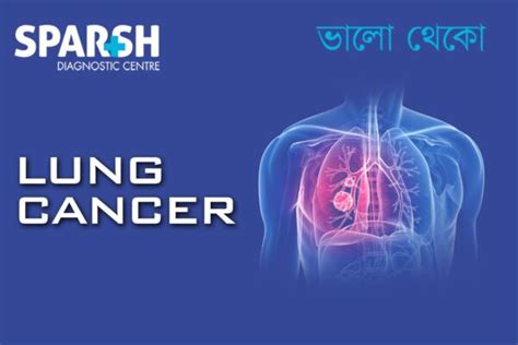 Lung Cancer Sparsh Diagnostic Center