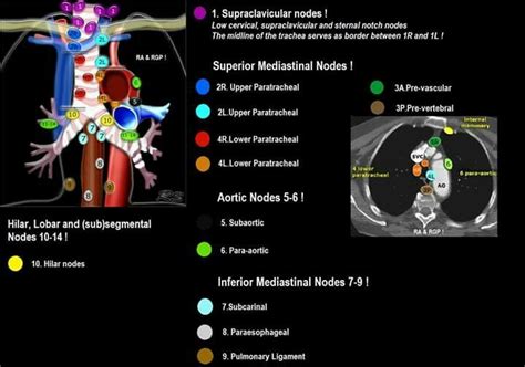 Bi Rads C Rads Gi Rads Li Rads Lu Rads Ti Rads Pi Rads The Long And Winding Road Of