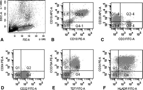 Pseudo Chediak Higashi Granules In Acute Lymphoblastic Leukemia A Rare Entity Abstract