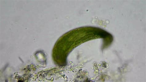 Green Algae Under Microscope 400x