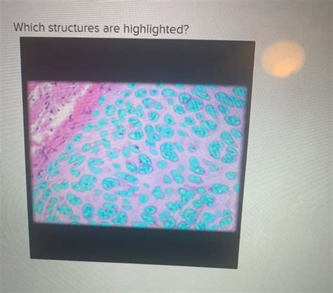solved which structures are highlighted multiple choice o