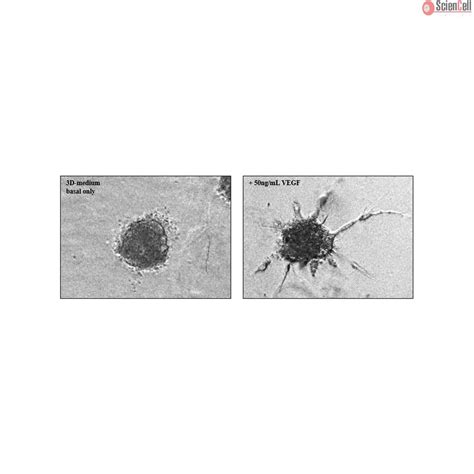 3d Angiogenesis Assay 3d Aa