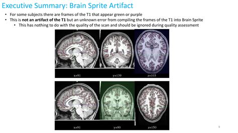 Quality Control For Infant Data Dcan Lab Readthedocs