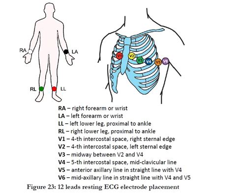 Printable 12 Lead Ecg Cheat Sheet Printable Calendars At A Glance