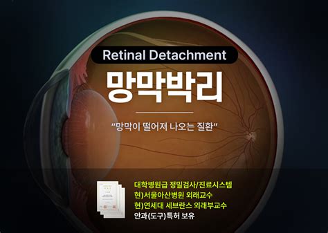 망막박리｜아이리움안과