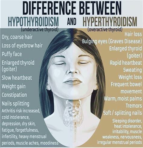 Hypothyroidism Dry Skin