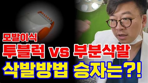 모발이식 삭발방법 무엇이 좋을까 Youtube