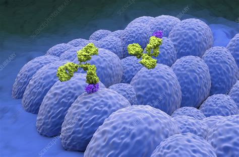 Monoclonal Antibody Therapy For Endometrial Cancer Illustration