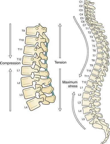 Thoracolumbar Spine Fractures Neupsy Key