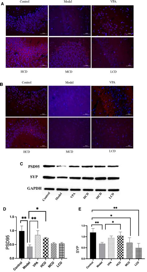 Psd95 And Syp Protein Expression By Immunofluorescence ×200 And