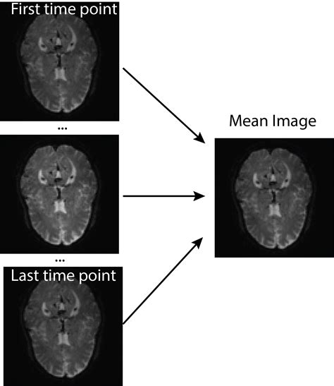 Neuroconductor Example Fmri Task Processing