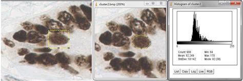 Immunohistochemistry Ihc Image Analysis Toolbox