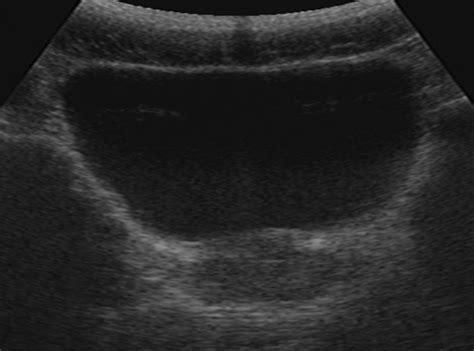 Male Pelvis Test 6 Study Set Flashcards Quizlet
