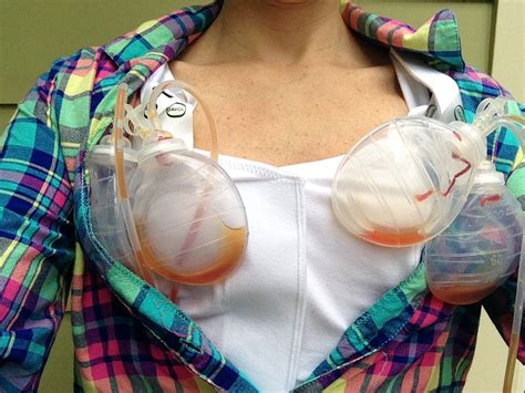 Mastectomy Drains