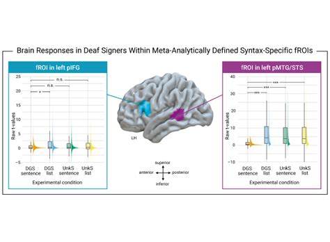 Modality Independent Core Brain Network For Language As Proved By Sign