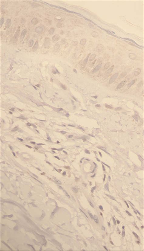 Thymocyte Selection Associated High Mobility Group Box As A Potential