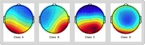 Microstate And Omega Complexity Analyses Of The Resting State Electroencephalography