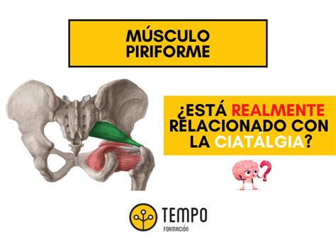 Músculo Piriforme Y Ciatálgias Tempo Formación