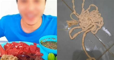 စအိုဝမှာ ၂ မီတာရှည်တဲ့ တိပ်ပိုးကောင်ကိုတွေ့လို့ အသားစိမ်းစားသူတွေကို