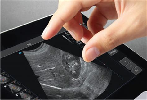 Capacitive Touch Screen