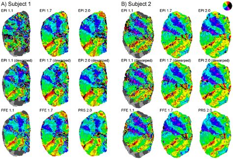 Retinotopic Activation Maps Displayed On Flattened Patches Of Occipital Download Scientific