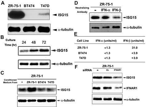 Figure 1 From Interferon β Signaling Contributes To Ras Transformation Semantic Scholar
