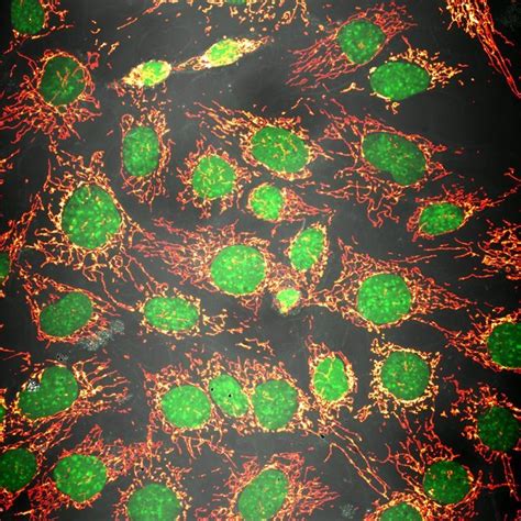 Mitochondria Stained Using Immunofluorescence For Tom20 Orange And Nuclei Using Dapi Green
