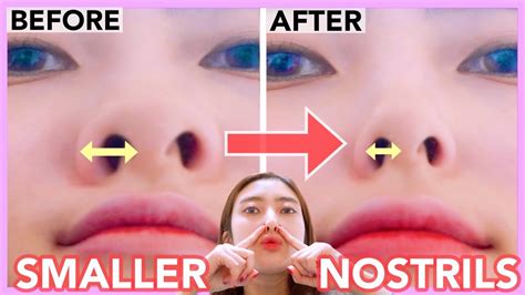 Make Nostrils Smaller Fix Wide Big Fat Nose Nostrils With This