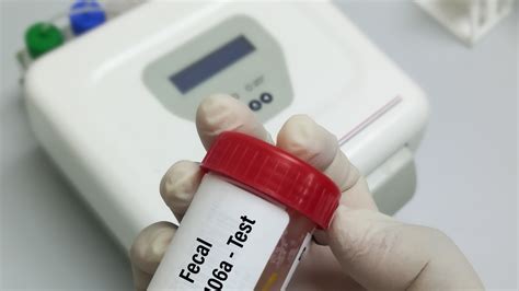 What Is Fecal Egg Counting In Sheep And Goat Sheep And Goat
