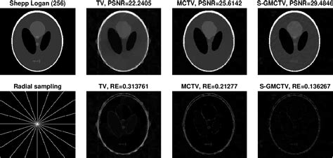 Figure 3 From A Symmetric Admm For Non Convex Regularization Magnetic Resonance Imaging