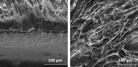 Figure 1 From Polylactide Polycaprolactone Asymmetric Membranes For Guided Bone Regeneration