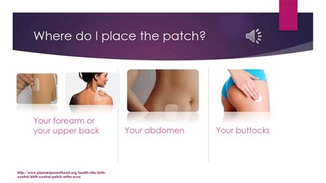 Where To Place The Contraceptive Patch At Richard Dolan Blog