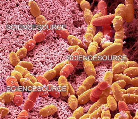 Streptococcus Mutans Scanning Electro Stock Image Science Source Images