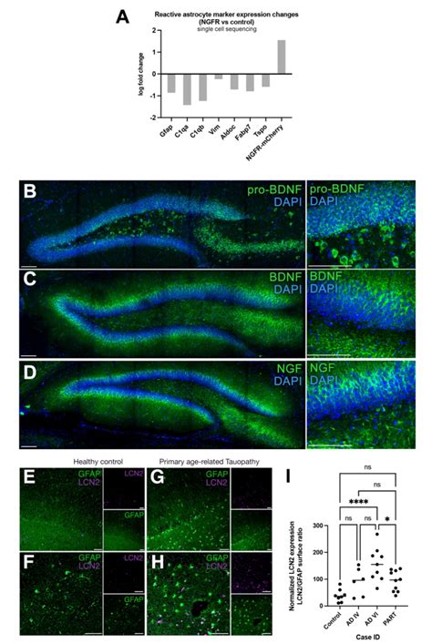 Fig S6 Reactive Astrocyte Markers In Single Cell Transcriptomics Download Scientific Diagram