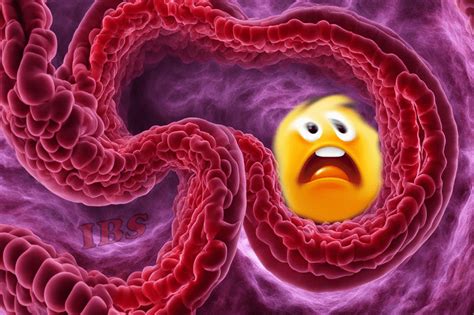 Understanding Your Irritable Bowel Syndrome