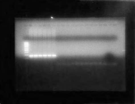 Empedobacter Brevis Semantic Scholar