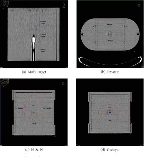 Figure 1 From The Patient Specific Qa Of Imrt And Vmat Through The Aapm
