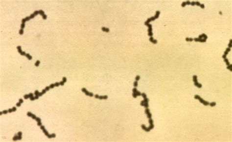 Streptococcus Wikipedia