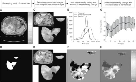 A Brief Scheme Illustrating The Threshold Dose Calculation And The