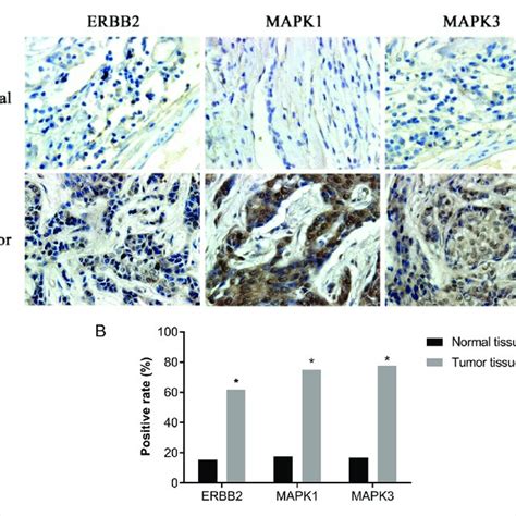 Immunohistochemical Detection Of Positive Rate Of Abnormal Expression