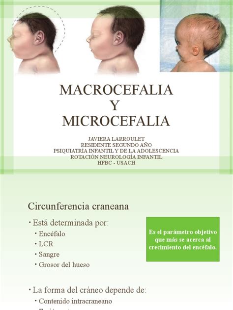 Macrocefalia Y Microcefalia Diagnóstico Y Causas Pdf Cráneo