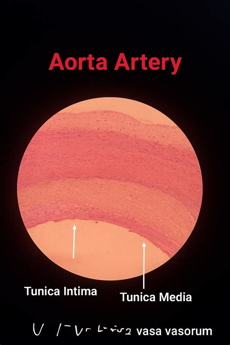 Aorta Artery Histology Slide Identification Points