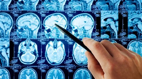 Brain Mri Tumor