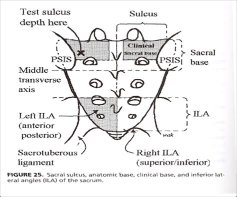 Sacral Sulcus