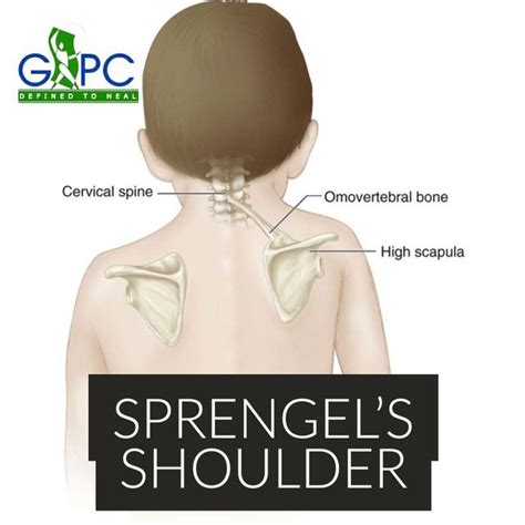 Pin On Nursing School Tips