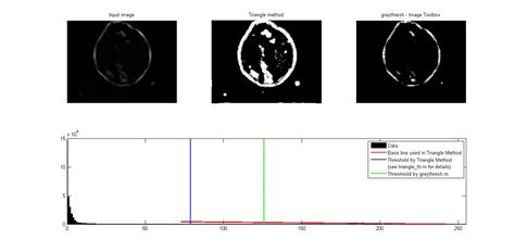 Matlab What Should Be The Ideal Thresholding Technique For Enhancing Parts Of The Image