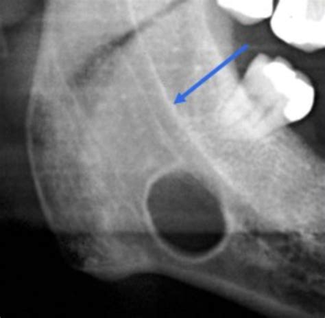 Radiology Lecture 12 6 What You Need To Know Flashcards Quizlet